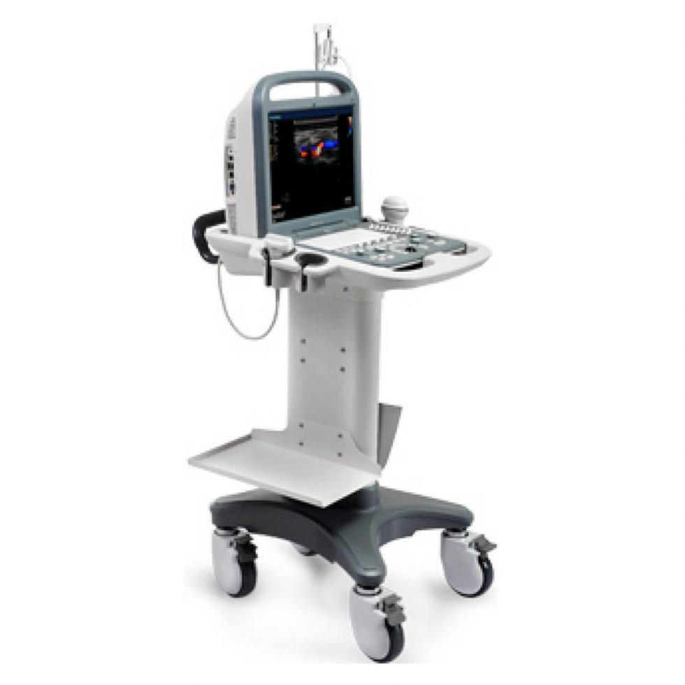 SonoScape S2 - Sonocamp Schmitt-Haverkamp